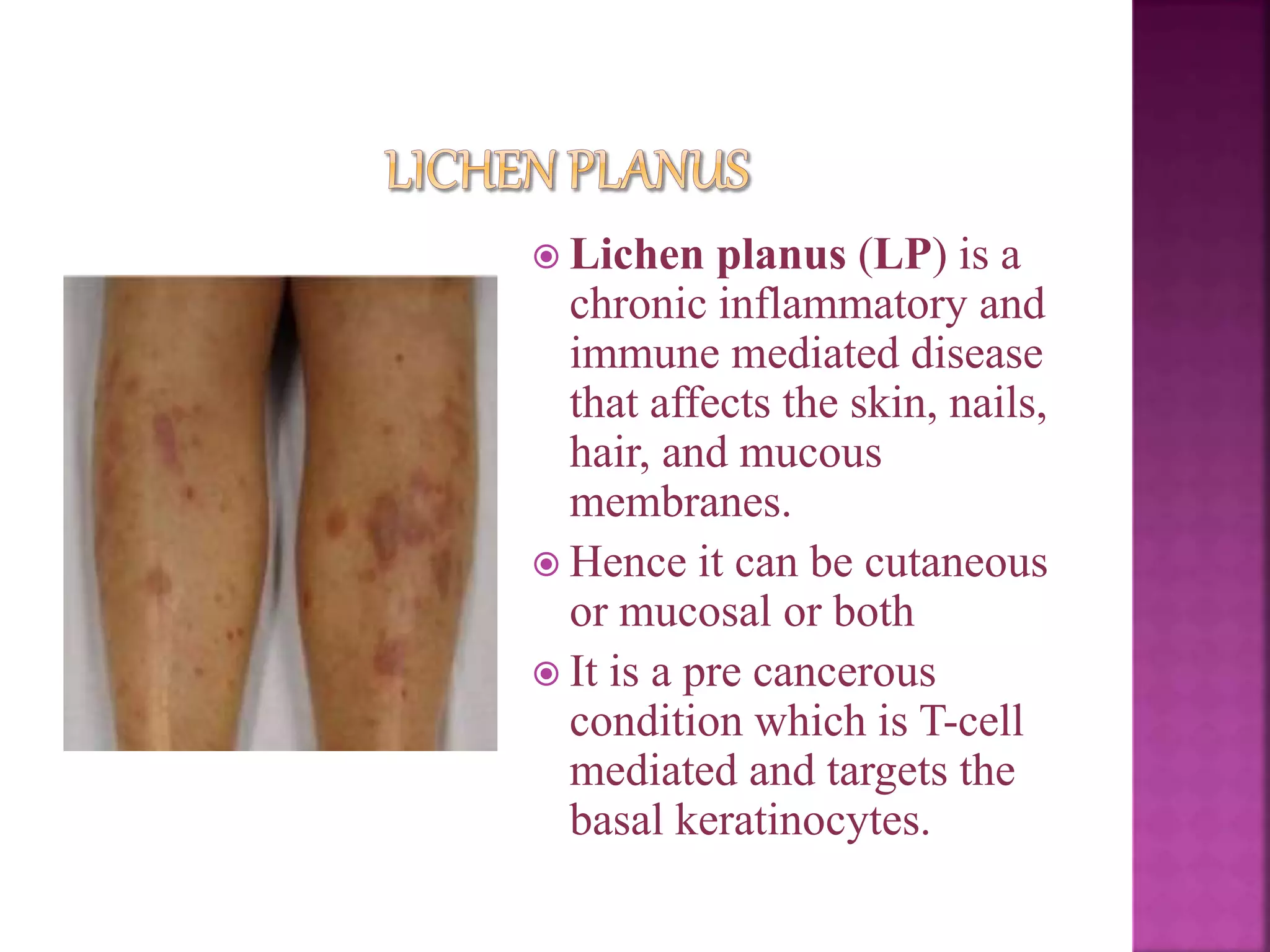 Lichen planus | PPTX