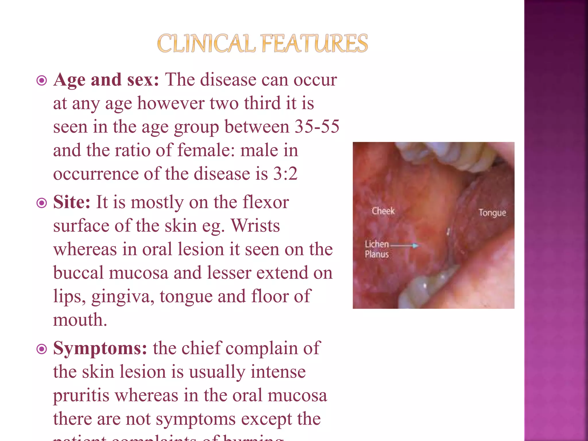 Lichen planus | PPTX