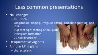 Lichen planus, MBBS VII Semester By Dr. Prajwal Pandey | PPTX