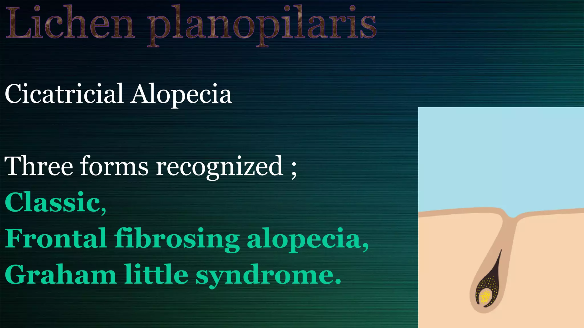 Lichen Planus.pdf