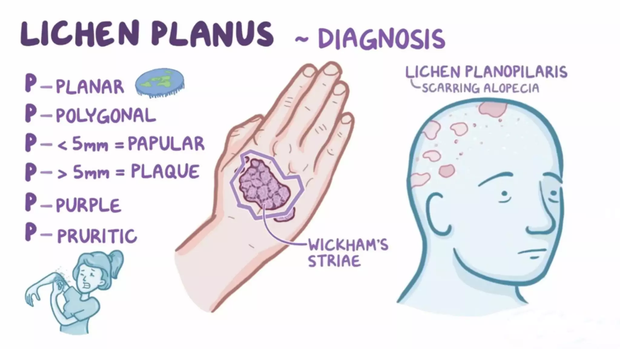 Lichen Planus.pdf