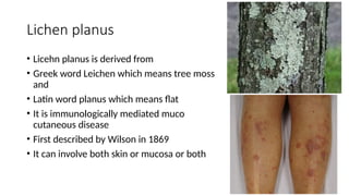 Lichen planus clinical features and histopathology .pptx | Ear, Nose and Throat Conditions ...