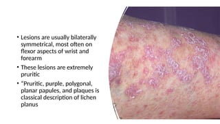 Lichen planus clinical features and histopathology .pptx | Ear, Nose ...