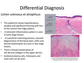 Lichen planus 2.0 | PPTX