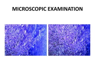 Lichen planus 2.0 | PPTX