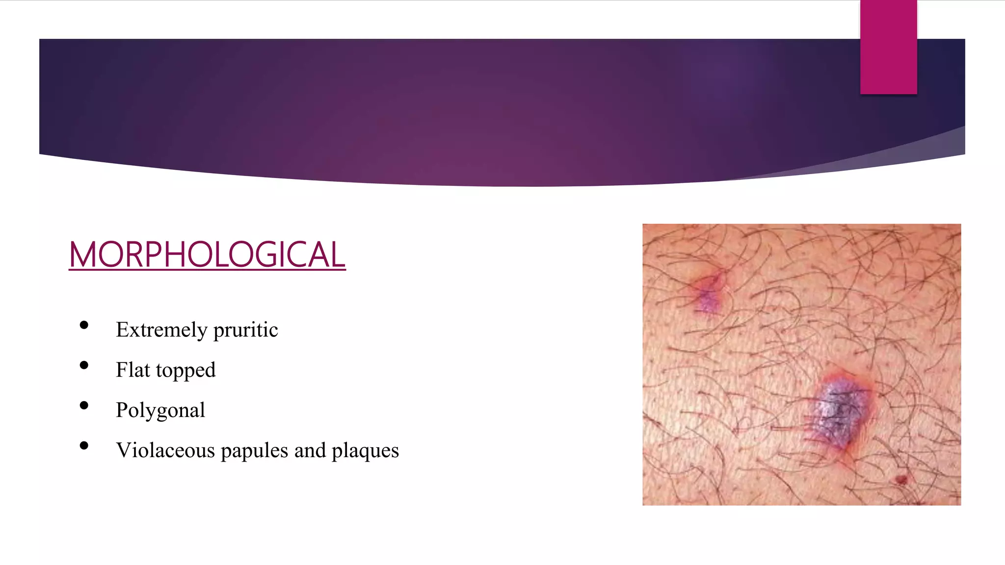 Lichen planus and lichenoid disorders | PPTX