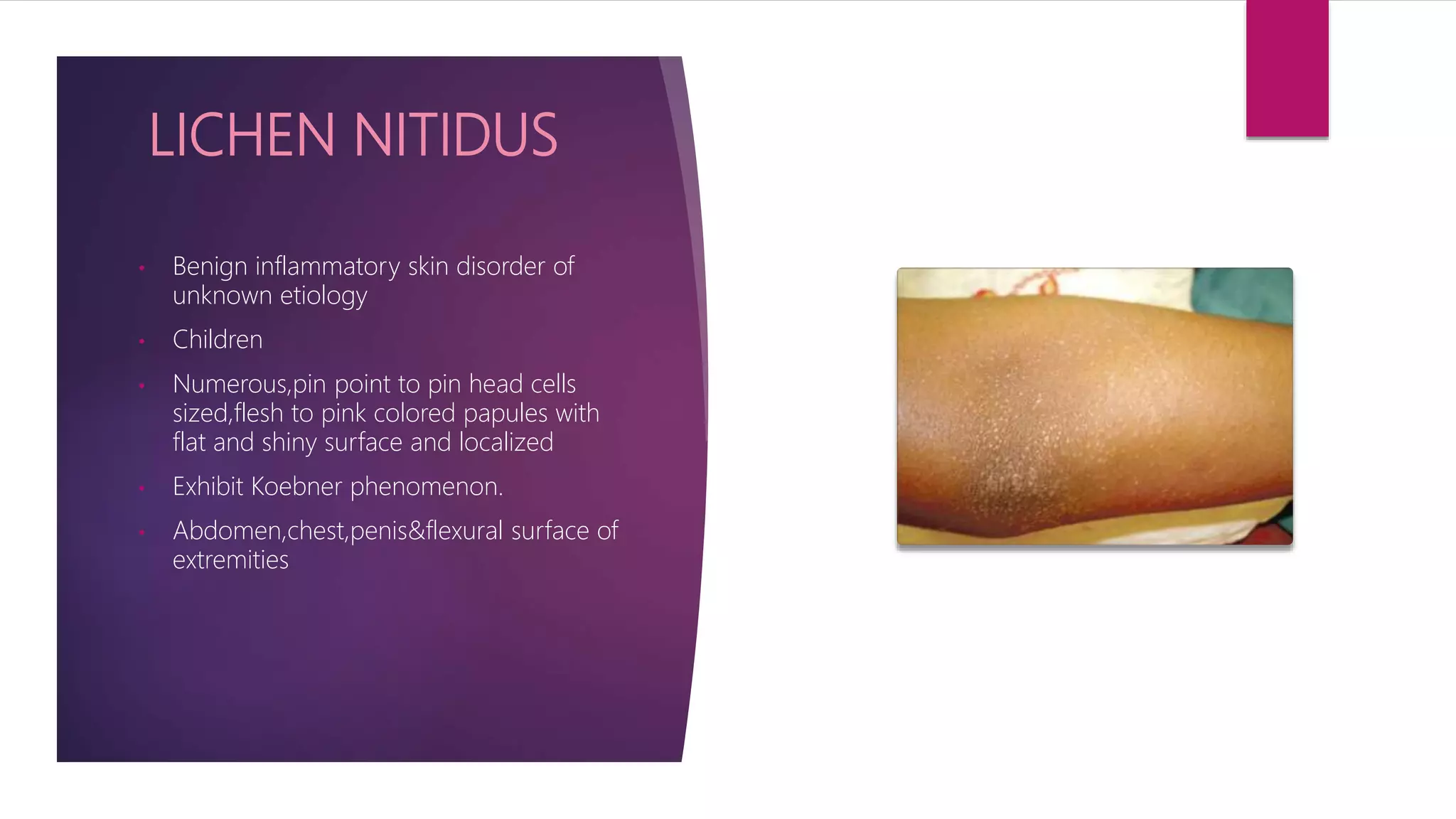 Lichen planus and lichenoid disorders | PPTX