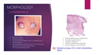 Lichen planus and lichenoid disorders | PPTX