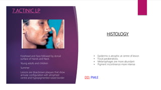 Lichen planus and lichenoid disorders | PPTX