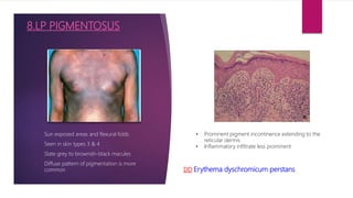 Lichen planus and lichenoid disorders | PPTX