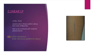Lichen planus and lichenoid disorders | PPTX