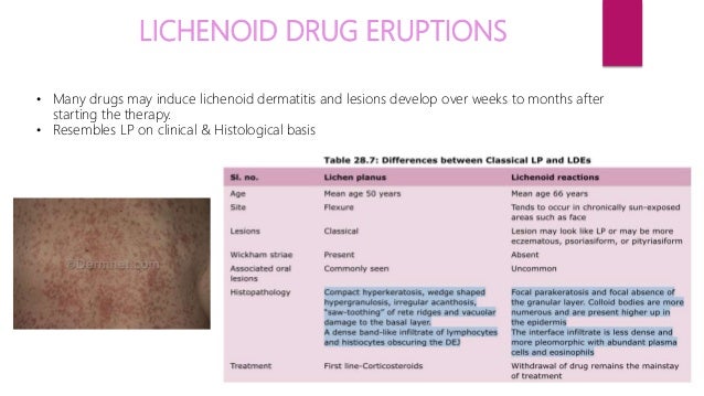 Lichen planus and lichenoid disorders