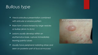 Oral Lichen Planus | PPT