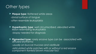 Oral Lichen Planus | PPT