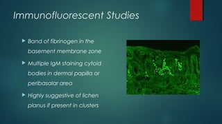 Oral Lichen Planus | PPT
