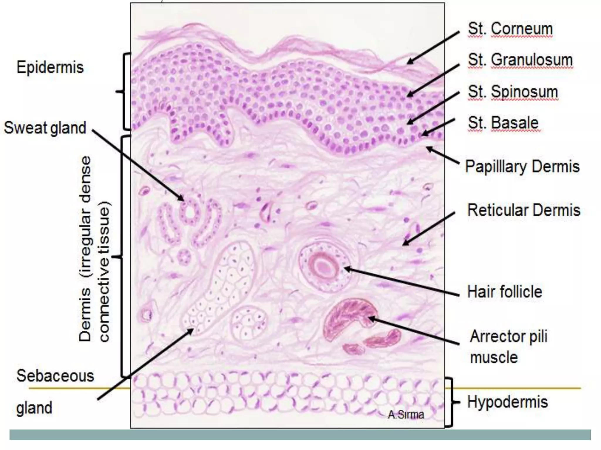 Lichen planus ppt | PPTX