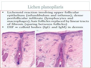 Lichen Planopilaris Histology