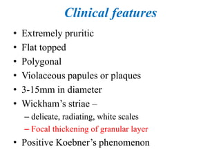 Lichen planus | PPTX