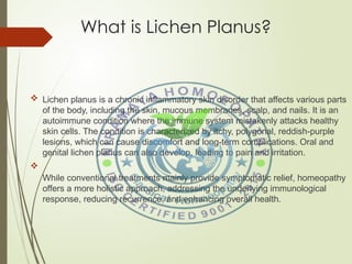 Lichen Planus:Causes , Symptoms and Homeopathic Treatment | PPT