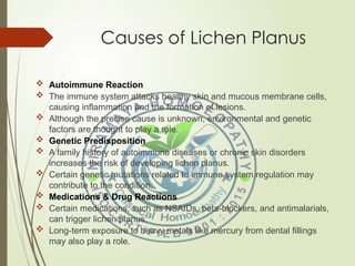 Lichen Planus:Causes , Symptoms and Homeopathic Treatment | PPT