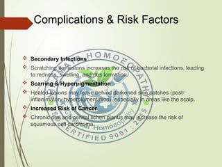 Lichen Planus:Causes , Symptoms and Homeopathic Treatment | PPT