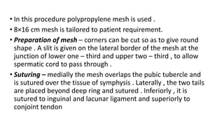 Lichtenstein hernioplasty surgery ppt.pptx