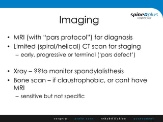 Pars defects and spondylolisthesis | PDF