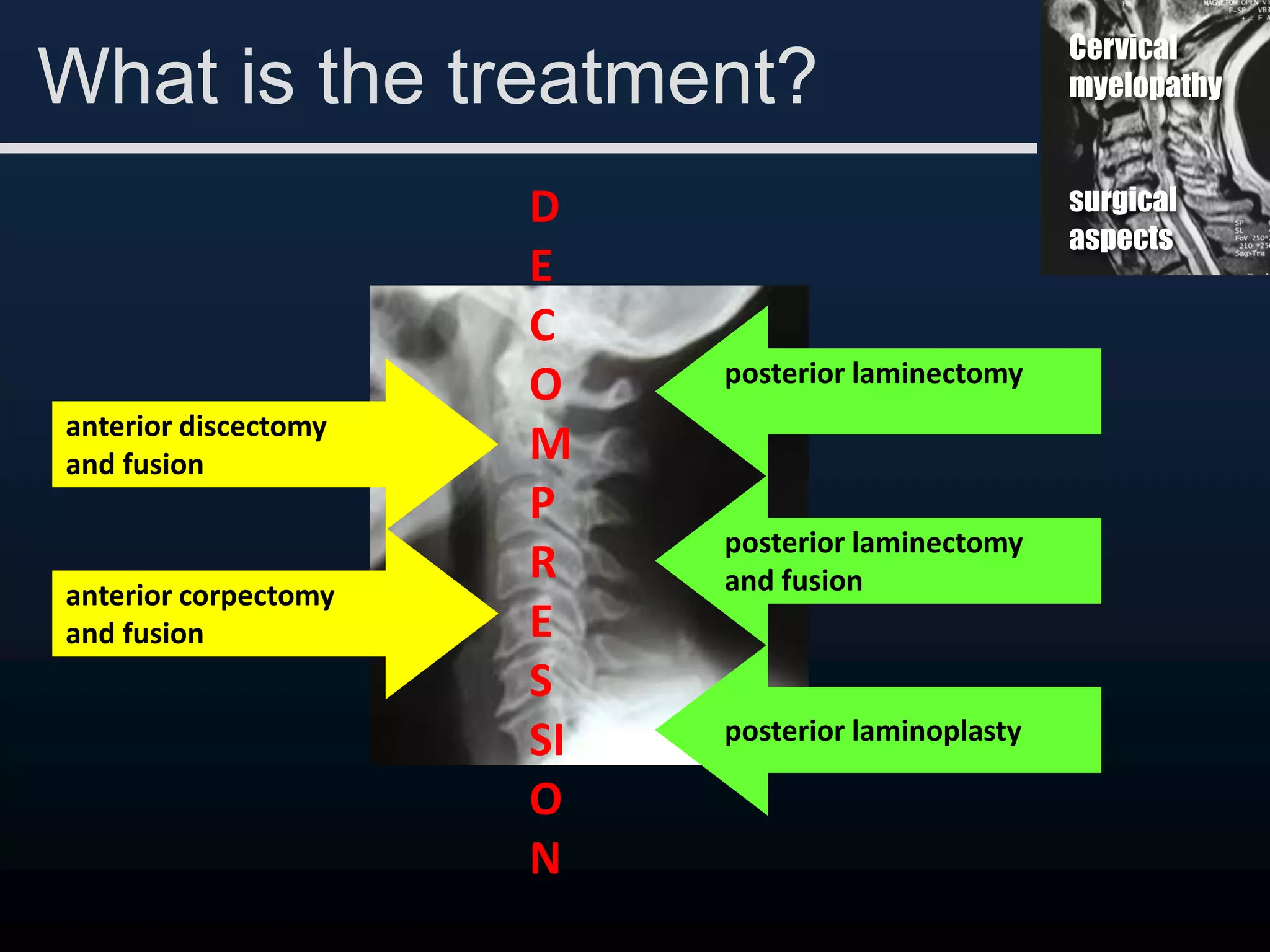 Assessment of the cervical spine in degenerative pathologies | PPT