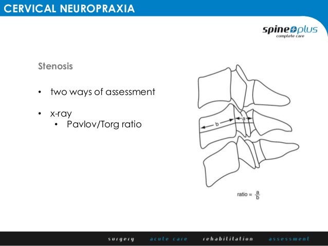 Guidelines for return to sport after cervical trauma