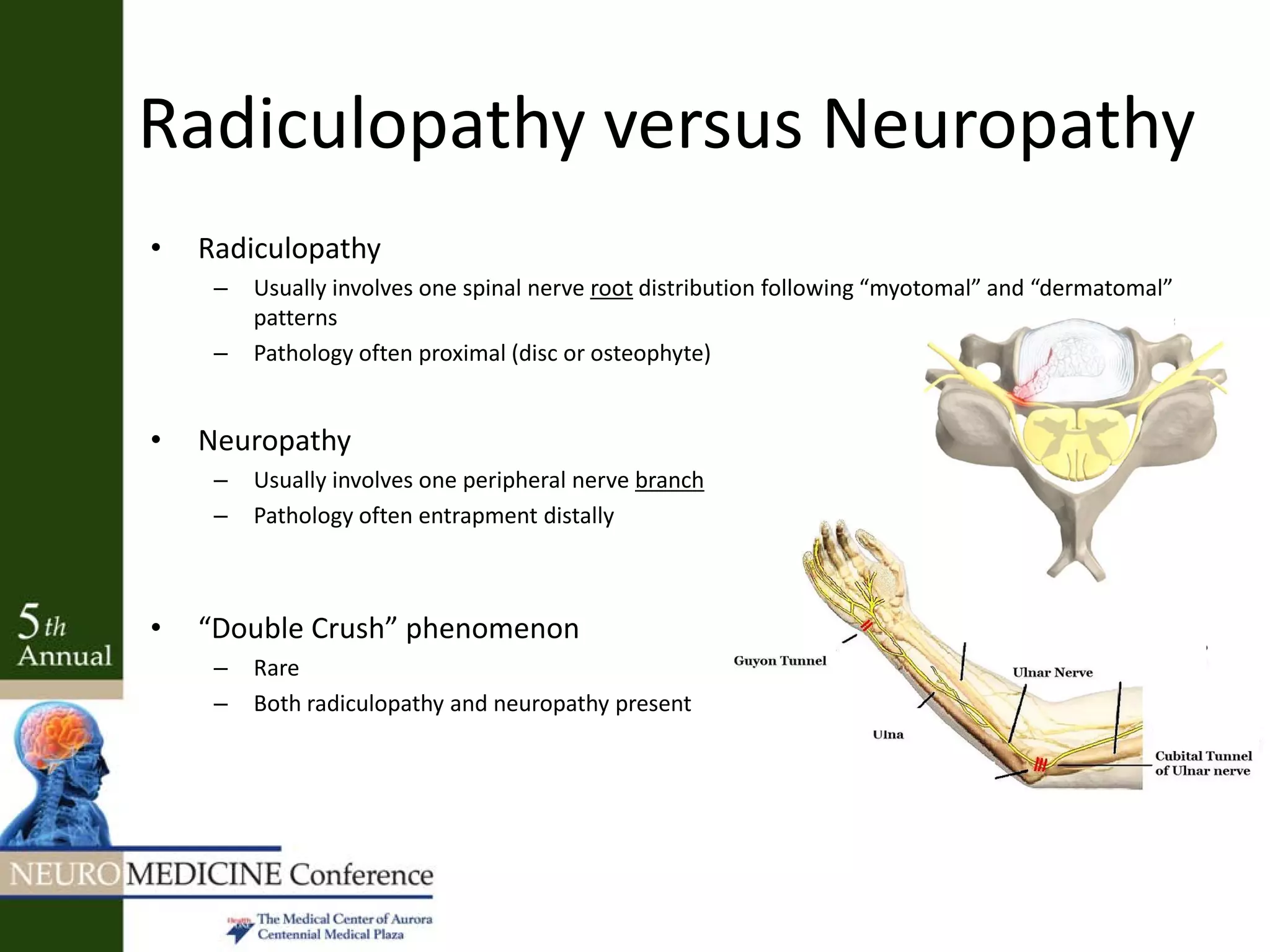 Radiculopathy vs peripheral neuropathy | PDF
