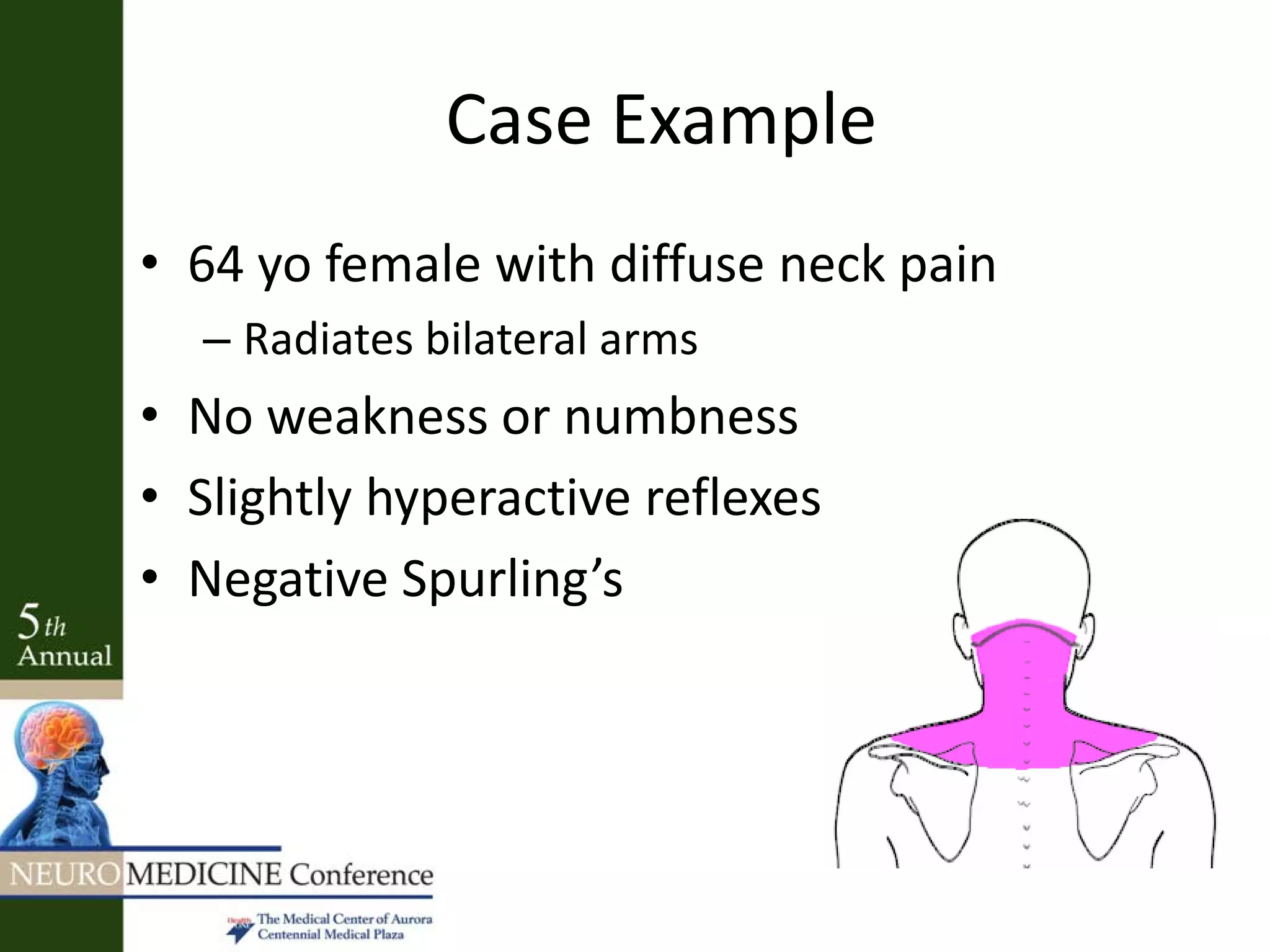 Radiculopathy vs peripheral neuropathy | PDF