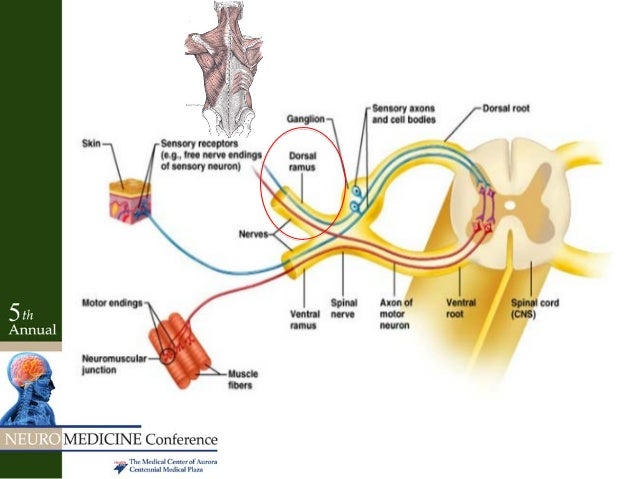 Radiculopathy vs peripheral neuropathy