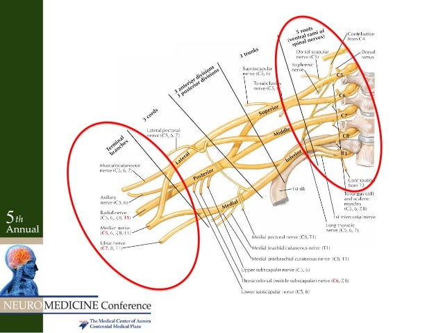 Radiculopathy vs peripheral neuropathy