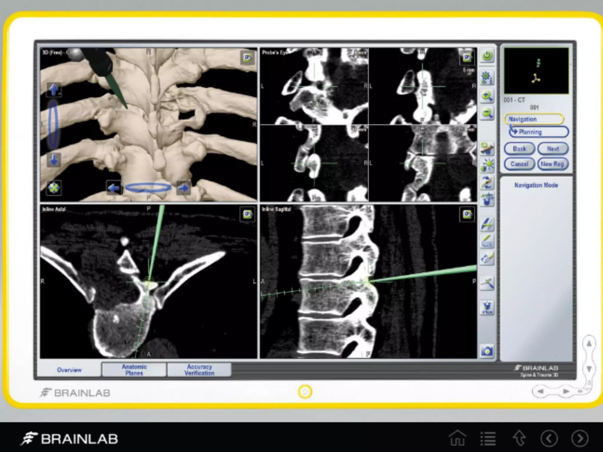 Surgery for low back pain | PPT