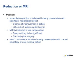 Unifacet dislocation MRI | PPT