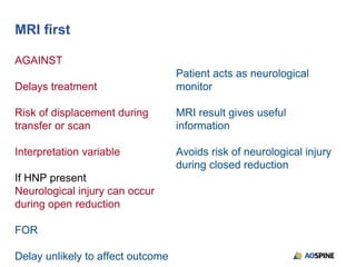 Unifacet dislocation MRI | PPT