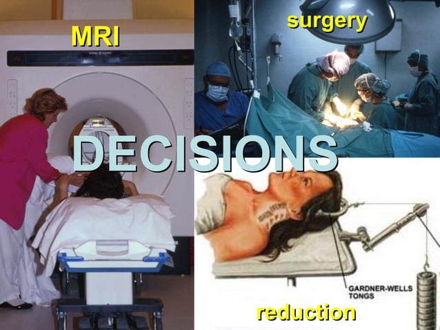 Unifacet dislocation MRI | PPT