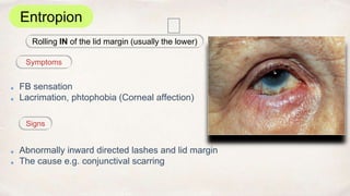 Lid 2 slideshare | PPTX