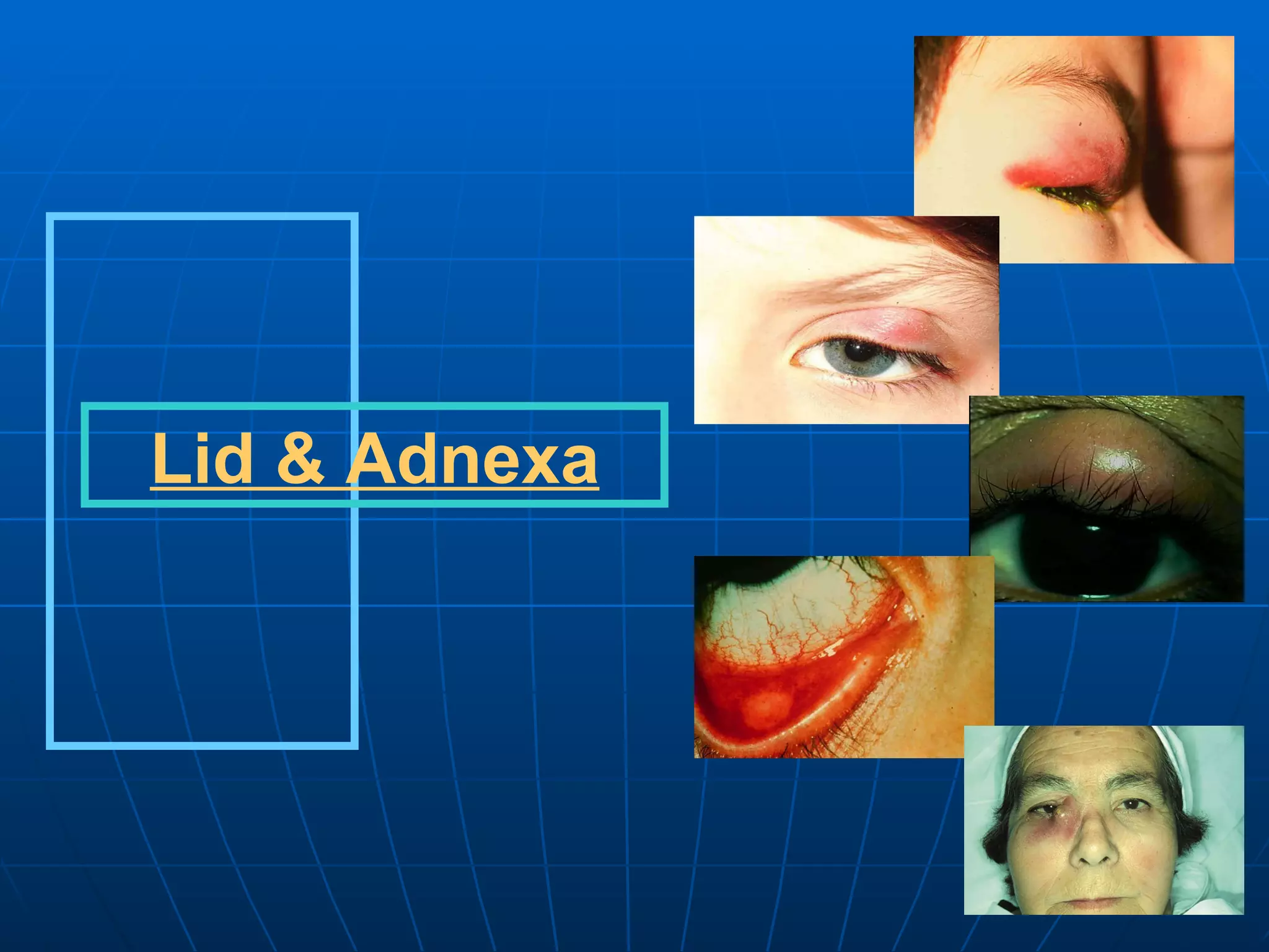 Lid & adnexa | PPT