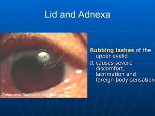 Lid & adnexa | PPT