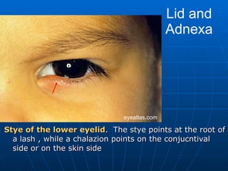 Lid & adnexa | PPT
