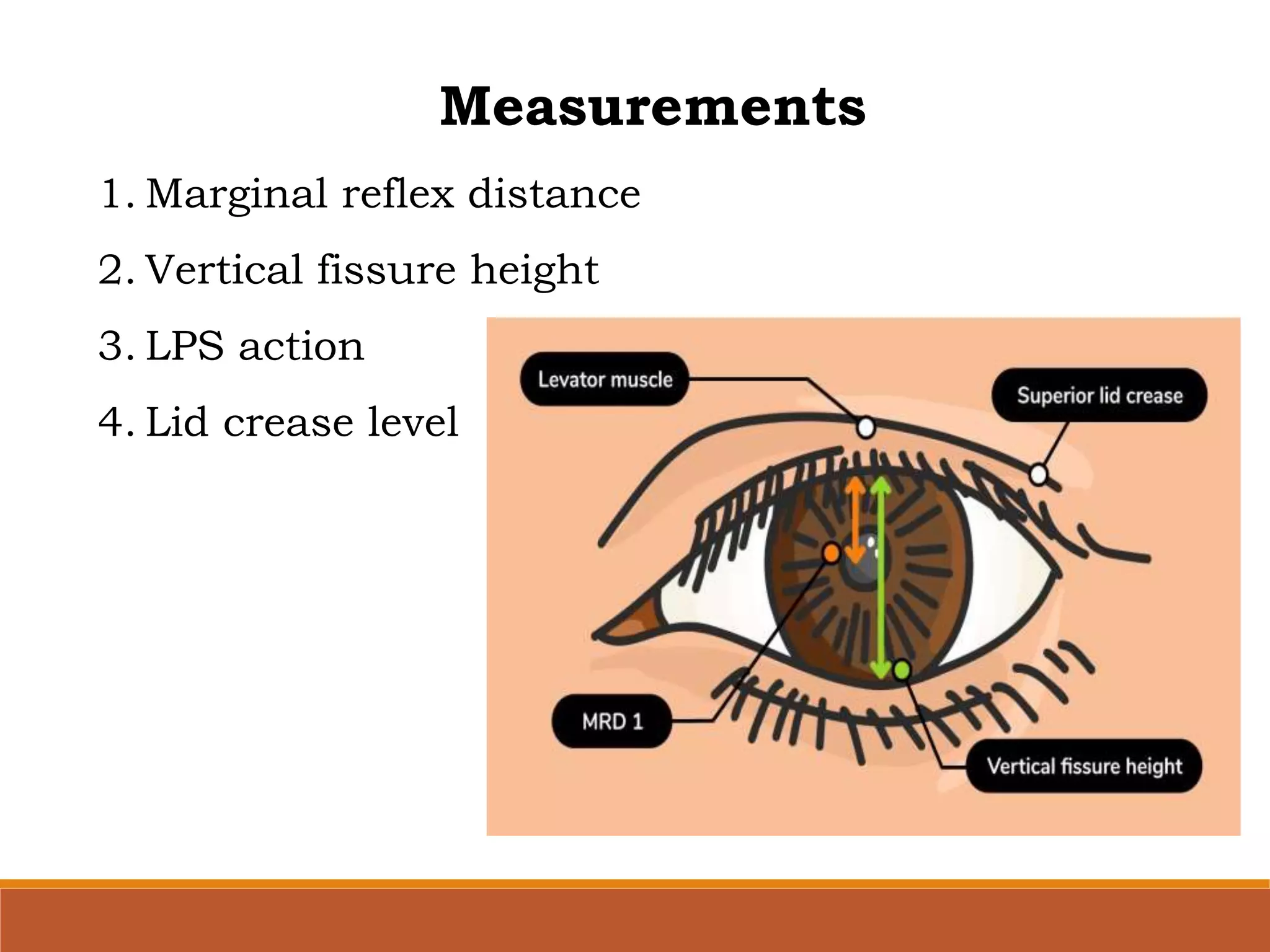 lid examiantion.pptx