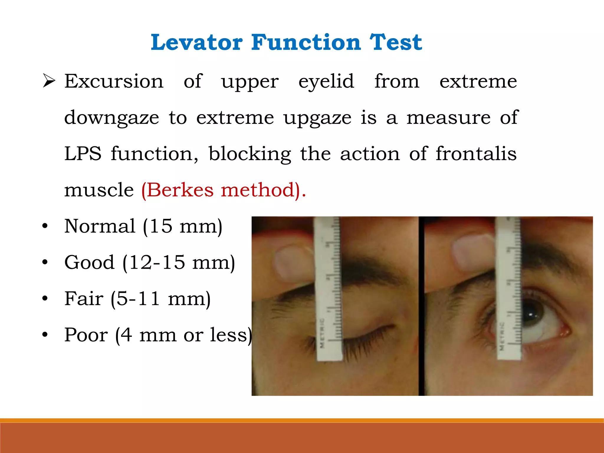 lid examiantion.pptx
