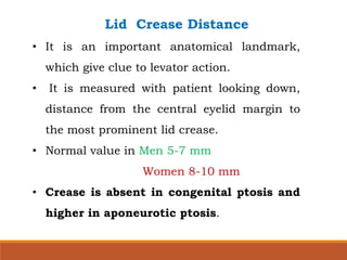 lid examiantion.pptx | Eye and Vision Conditions | Diseases and Conditions