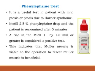 lid examiantion.pptx
