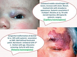 Lid lesions | PPTX