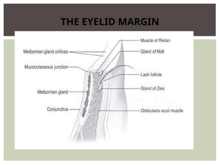 lid margin anomalies and lid aperture disorders.ppt