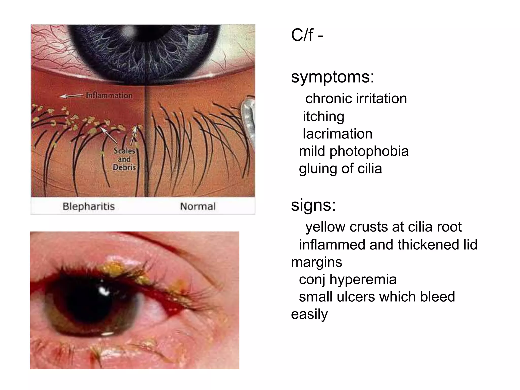 Lid Pathologies.pptx
