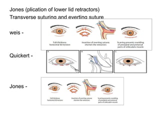 Lid Pathologies.pptx | Free Download