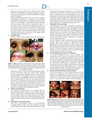 Lid reconstruction | PDF